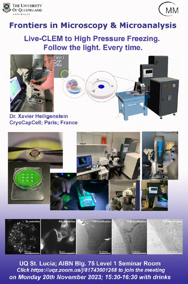 Frontiers Seminar: Live-CLEM to High Pressure Freezing. Follow the light. Every time. - Centre ...